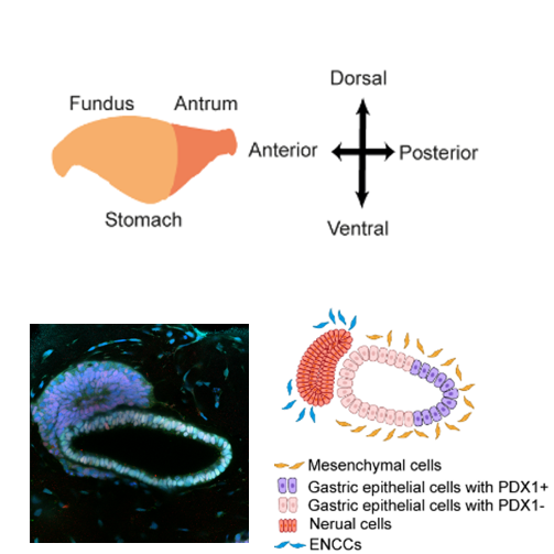 Generation of human gastroid with fundic-antral patterning using ...