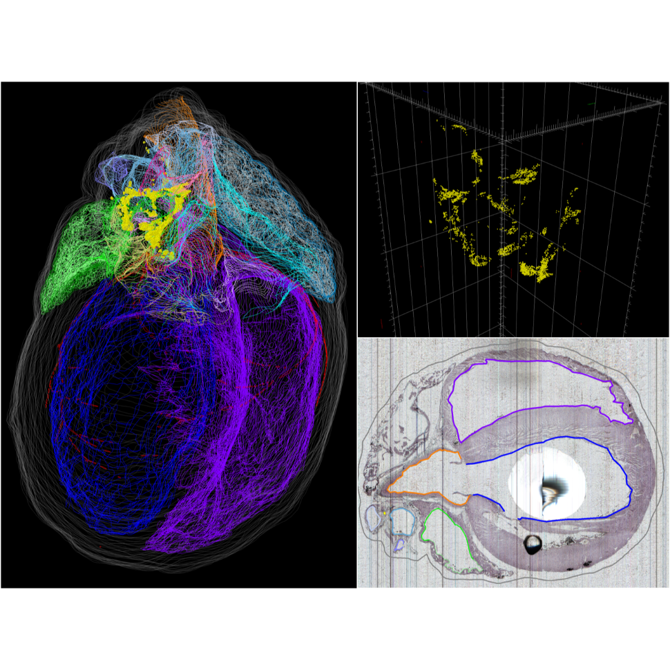 Single-Cell ICN Neuron Mapping and 3D Heart Reconstruction with Tissue ...