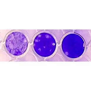 Viral Titration of SARS-COV-2 by Plaque Assay (Semi-Solid Agarose)
