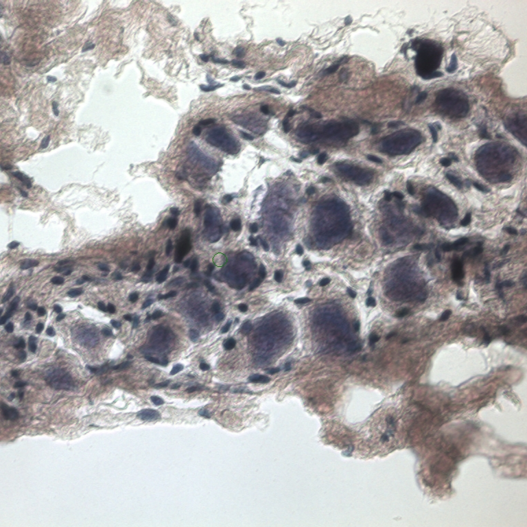 Staining/Dehydration 10 micron Rat Heart