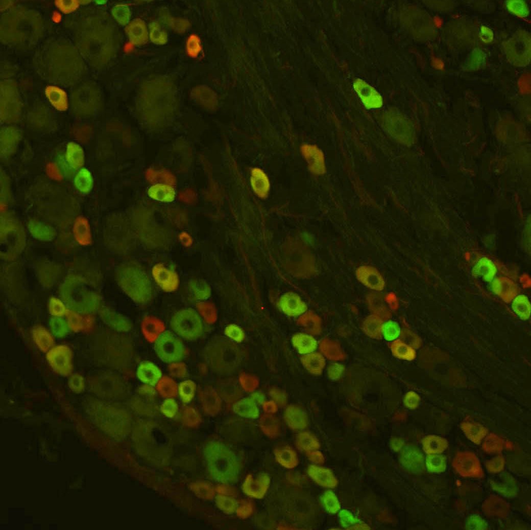 Intracardiac perfusion with fixative for anatomical studies [keast-001 ...