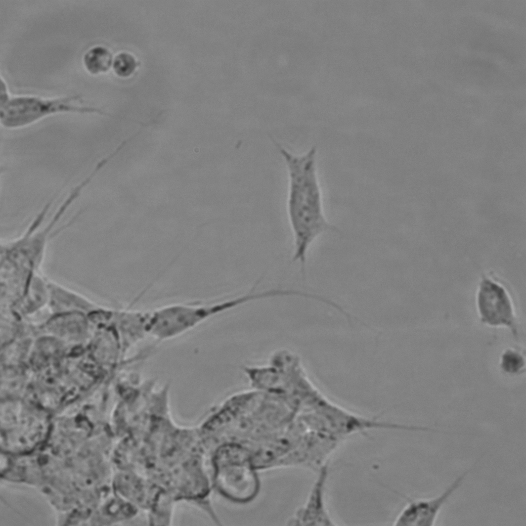 Mammalian Cell Culture: Refreshing Media