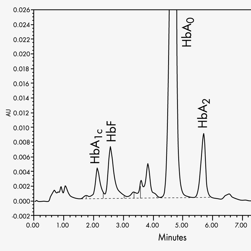 HPLC sample prep