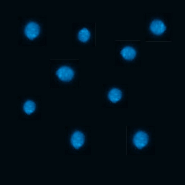 Isolation of single nuclei from solid tissues