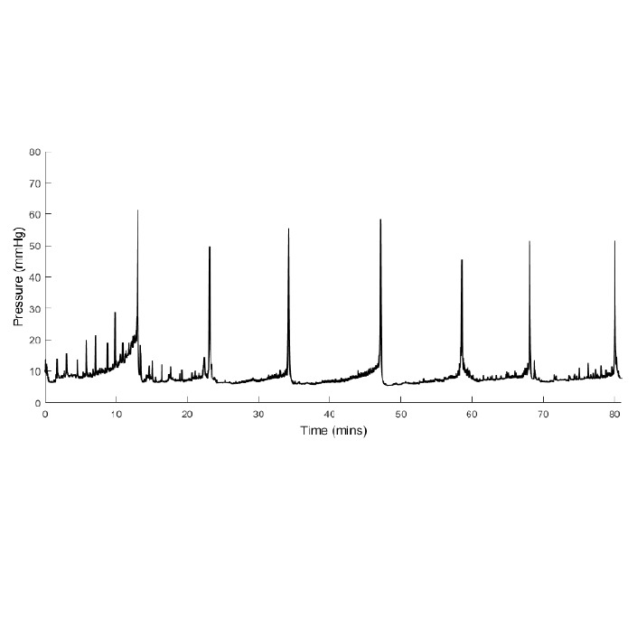 Cystometry in awake rats