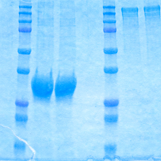 Colloidal Coomassie Blue Stain: Recipe and Protocol