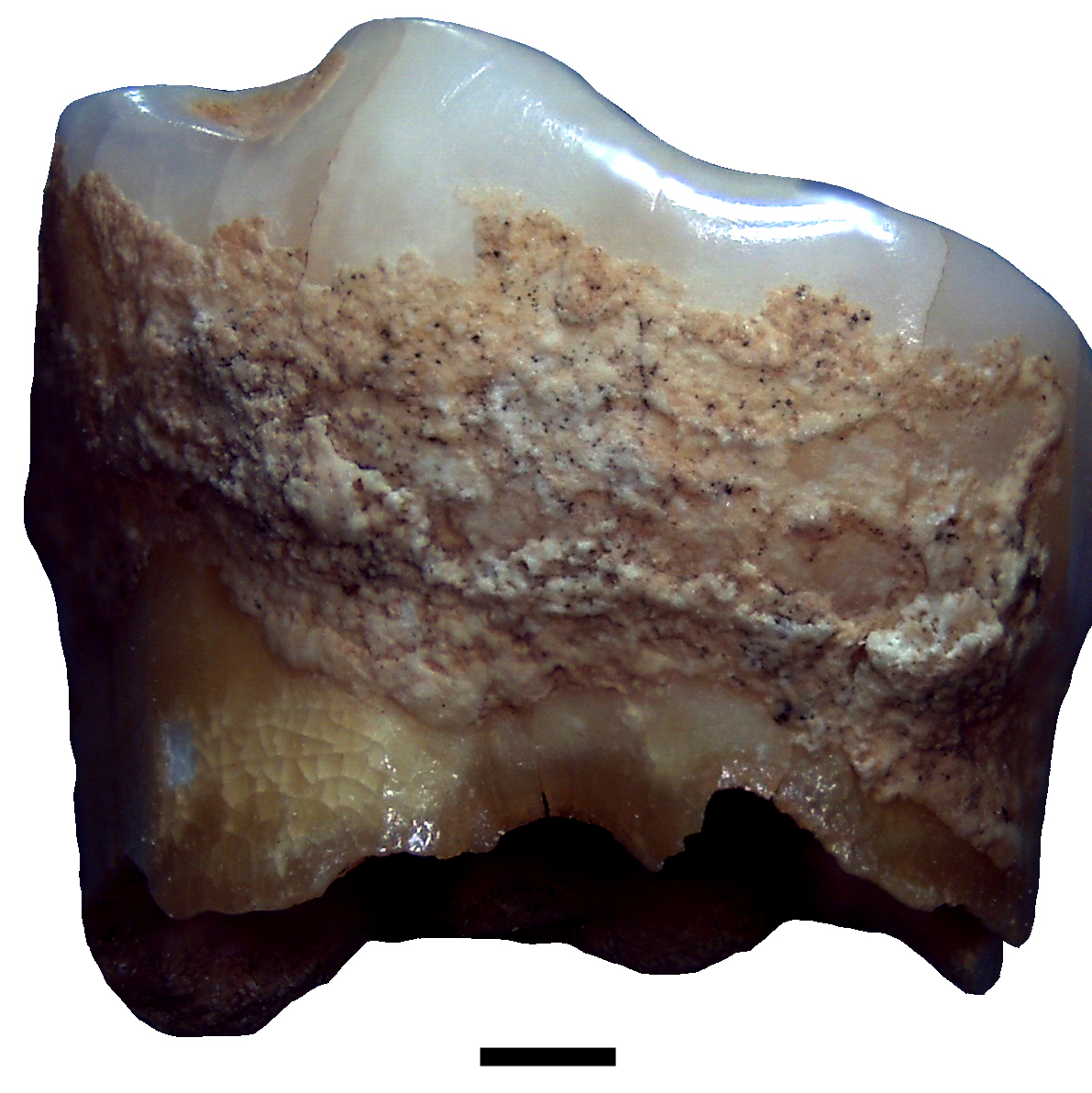 Ancient DNA Extraction from Dental Calculus