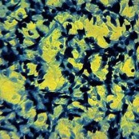 Protocol for STO Cell Transfection by FuGENE HD