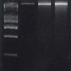 DNA Digestion with DNase I